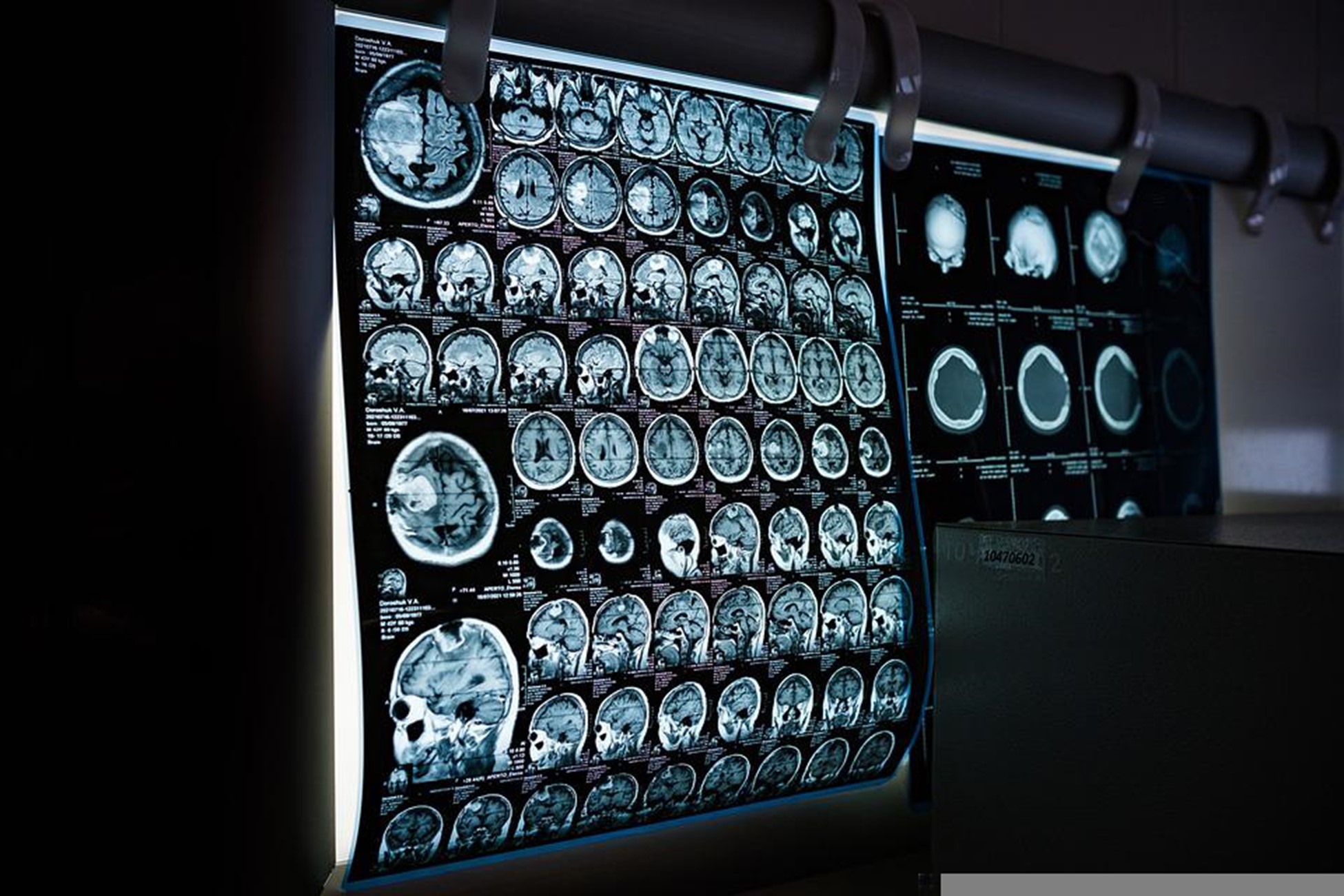 Reasons You May Require an MRI Scan - The Healthcare Guys