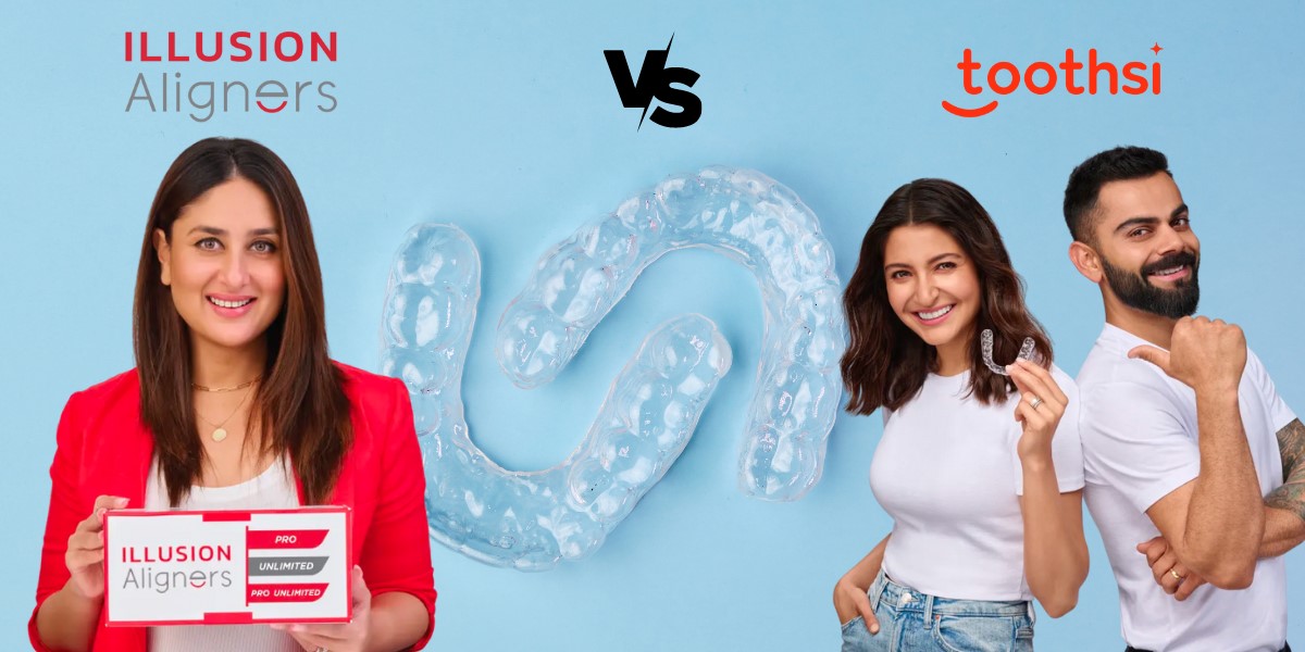 Illusion Aligners or Toothsi: Which Is the Right Choice for You? | The ...