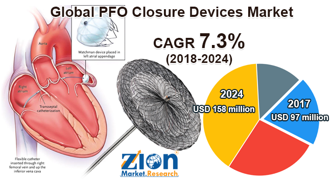Global PFO Closure Devices Market Estimated to Cross USD 158 million by ...